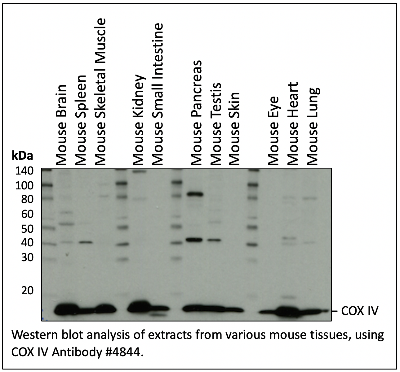 Mouse Tissue Loading Controls
